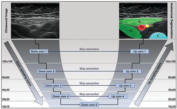 Anaesthesia, nerve blocks and artificial intelligence | Association of ...